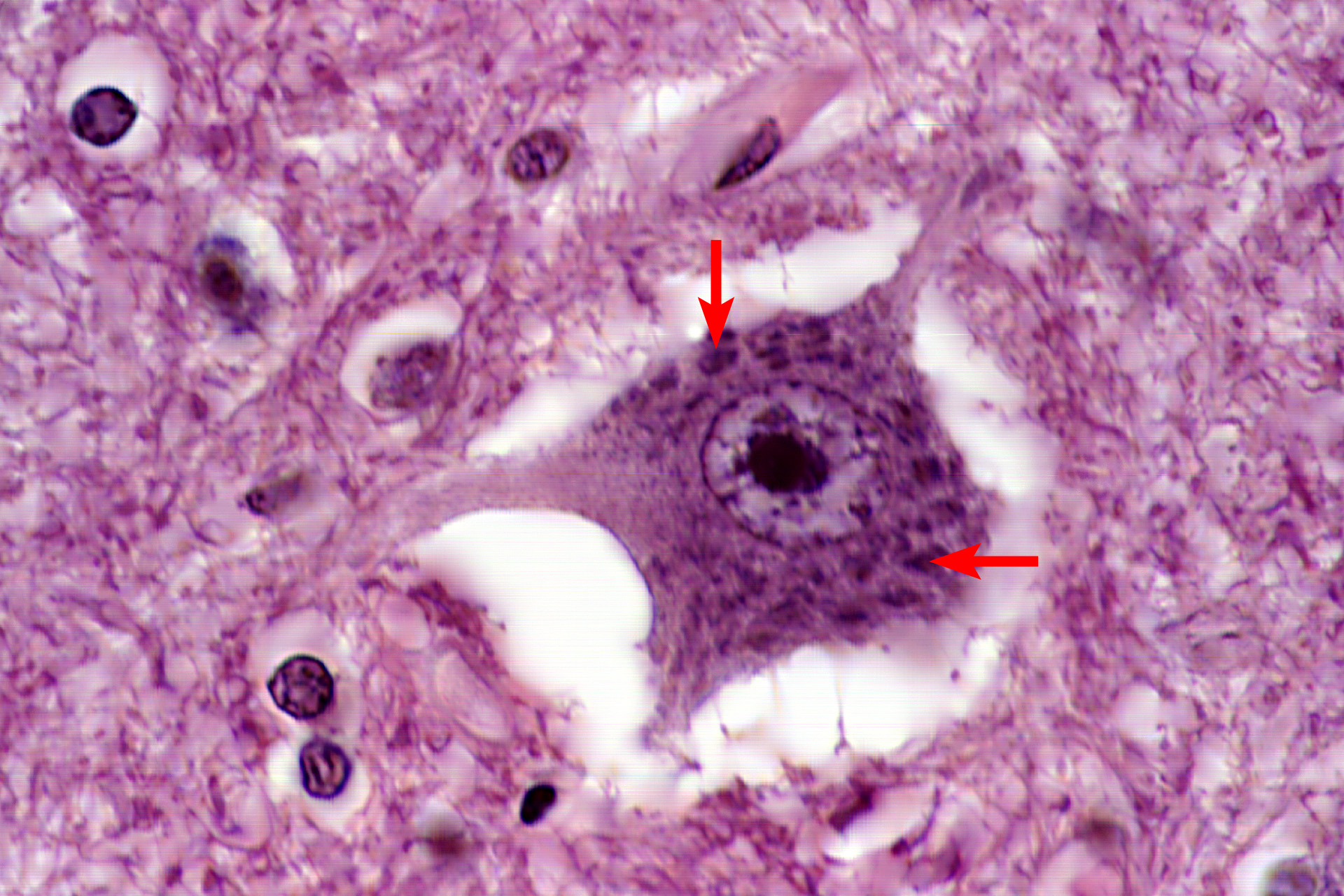 Nervous Tissue Slides
