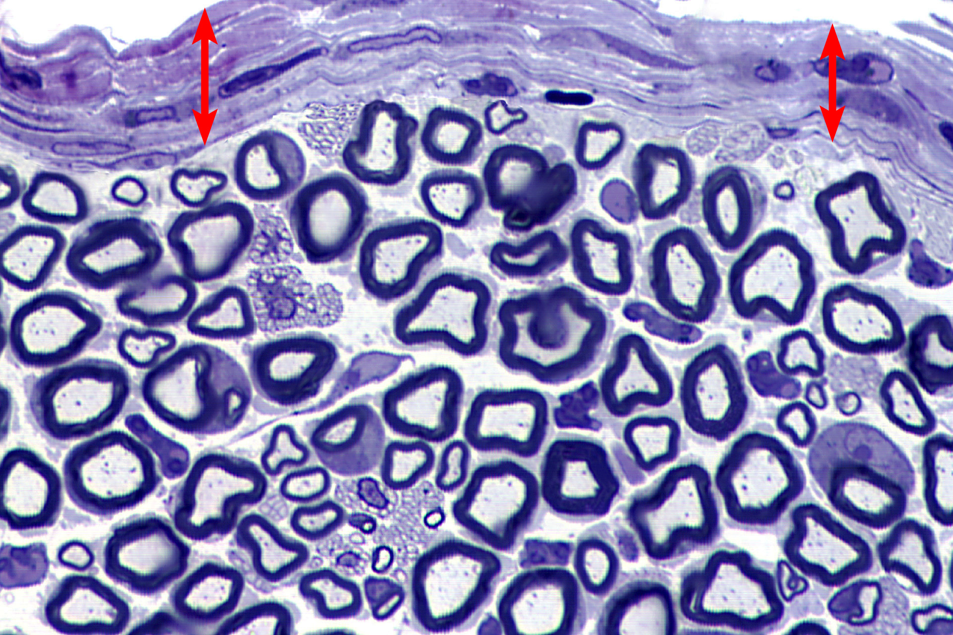Nervous Tissue Cell Slide