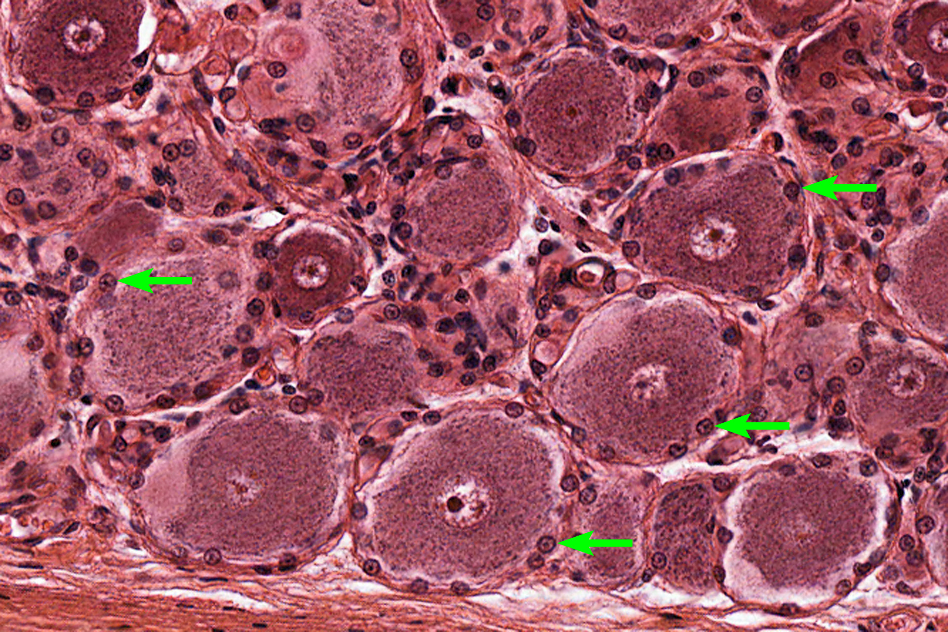 Nerve Histology