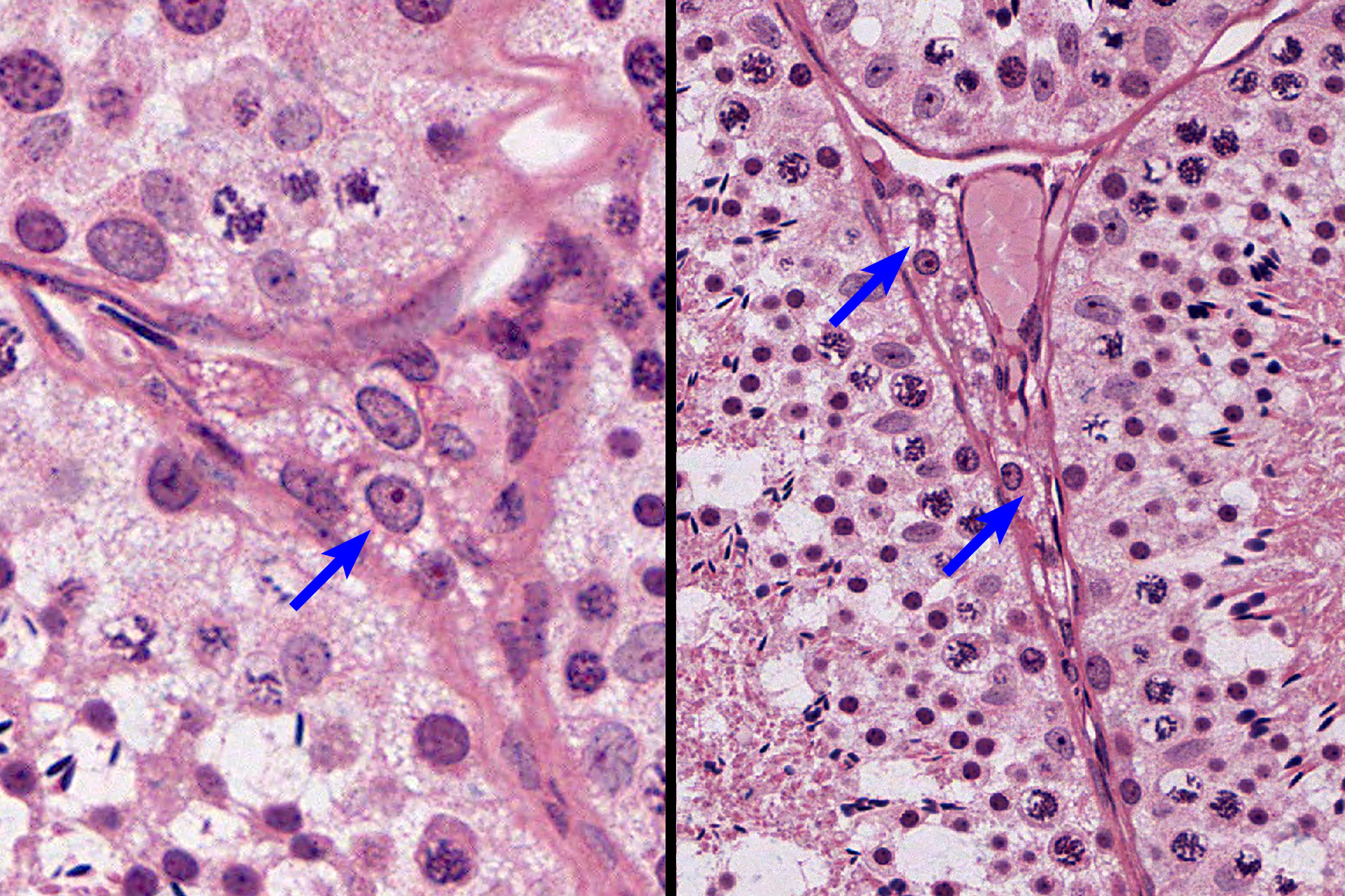 Male Reproductive System Histology At University Of