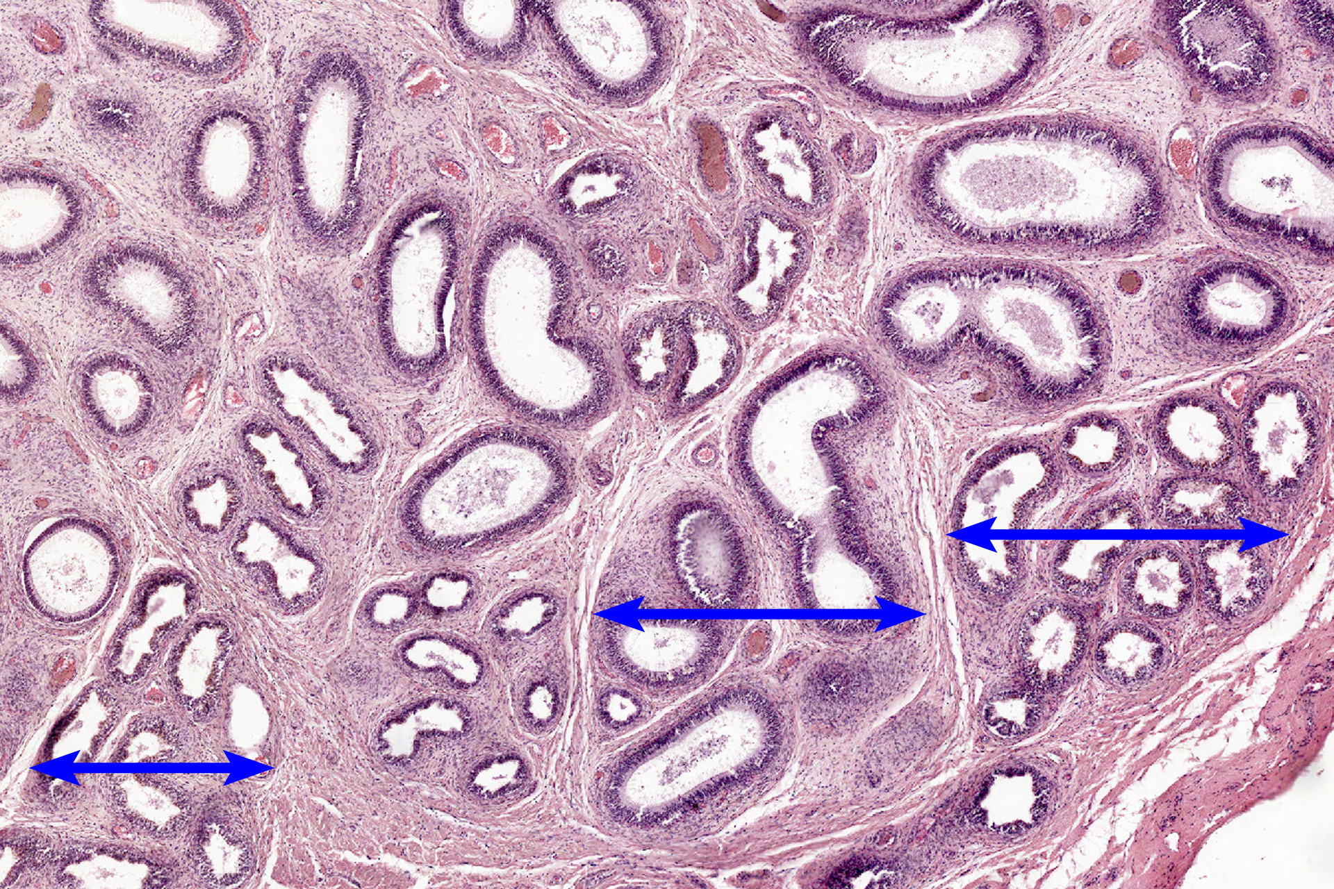 Pampiniform Plexus Histology