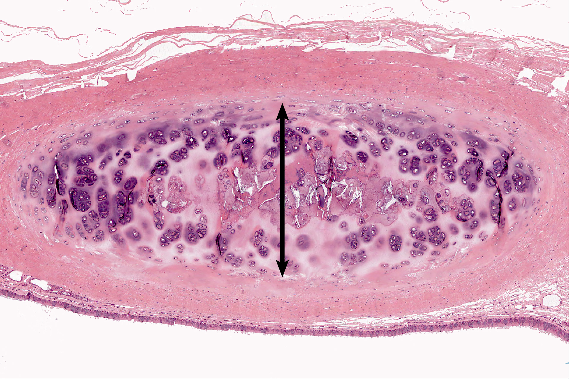 Connective Tissue Slides Quiz